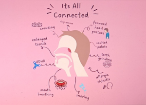 The Effects of Jaw Problems on the Rest of the Body - Osteopathic ...